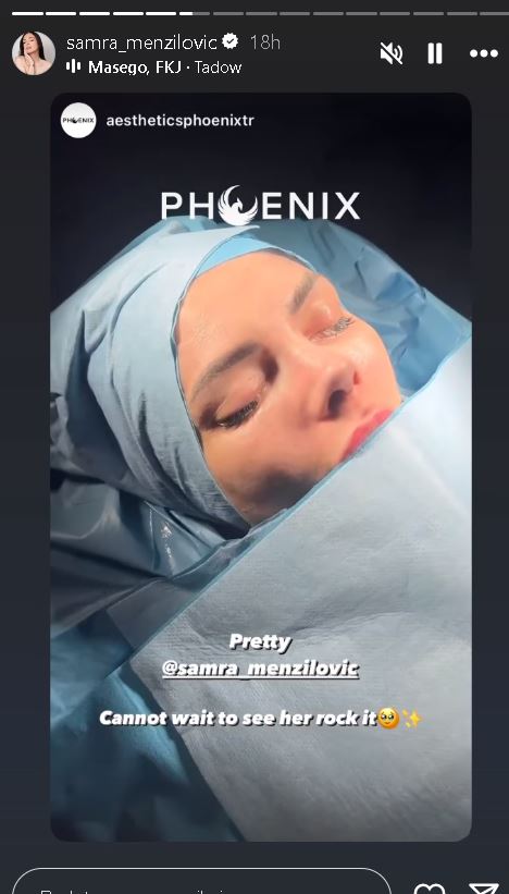 Još jedan estetski zahvat Samre Menzilović - Ćatić, operisala nos pa ...